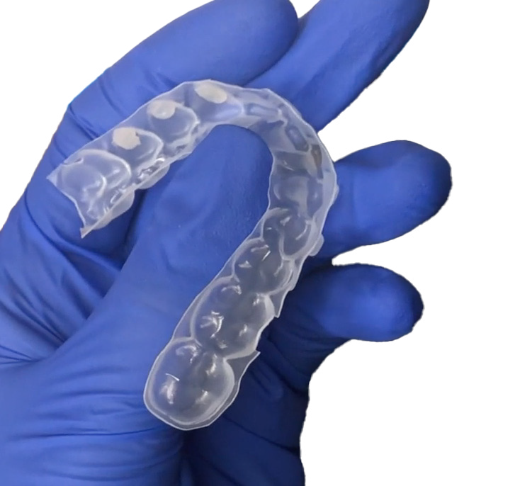 Spark™ - Innovative & Advanced Clear Aligner System